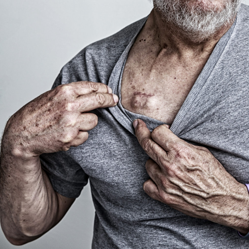 TIVAD® Lawsuit | TIVAD Lawyer, Attorney